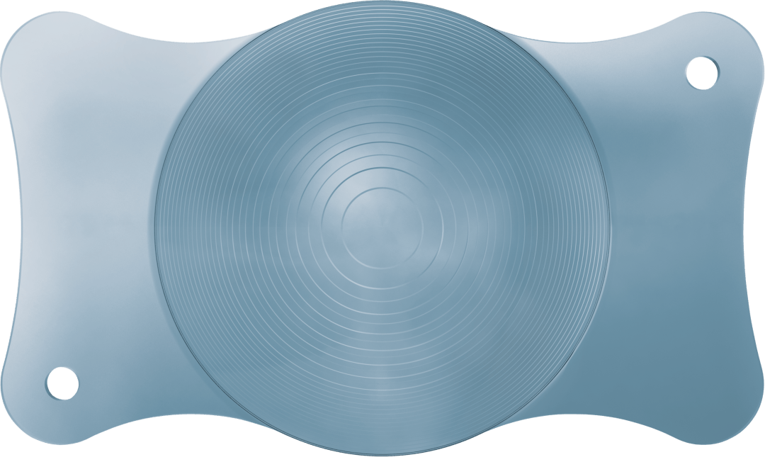 祝贺！蔡司新型三焦点人工晶体全国首批植入_西格玛医学官方网站